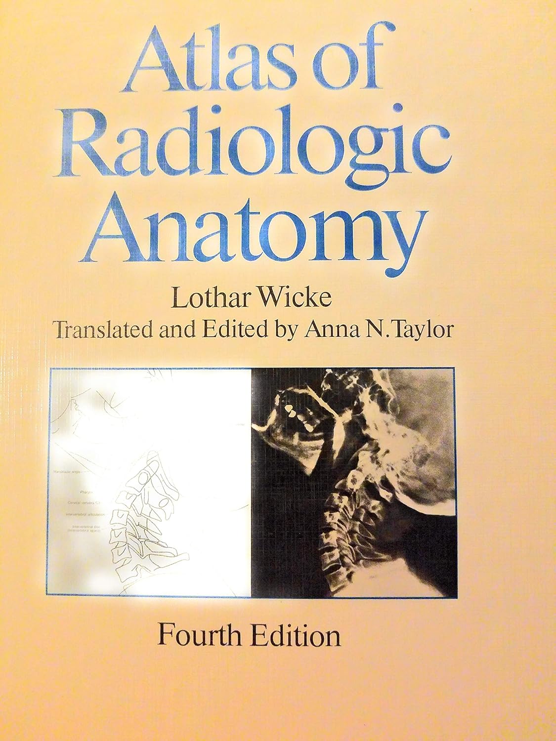 Atlas of Radiologic Anatomy: Amazon.co.uk: Wicke, Lothar: 9780806721149 ...