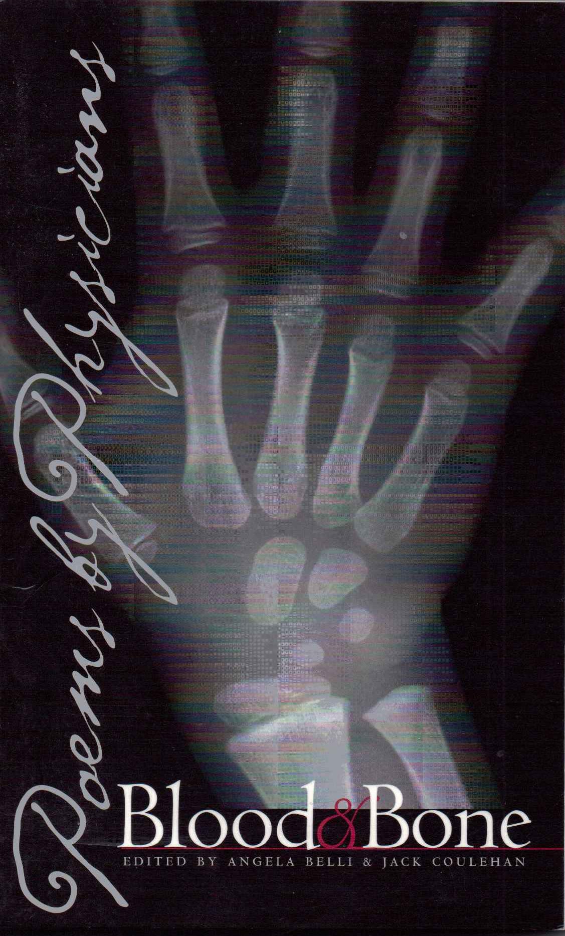 Blood and Bone: Poems by Physicians: Belli, Angela, Coulehan, Jack: 9780877456384: Amazon.com: Books