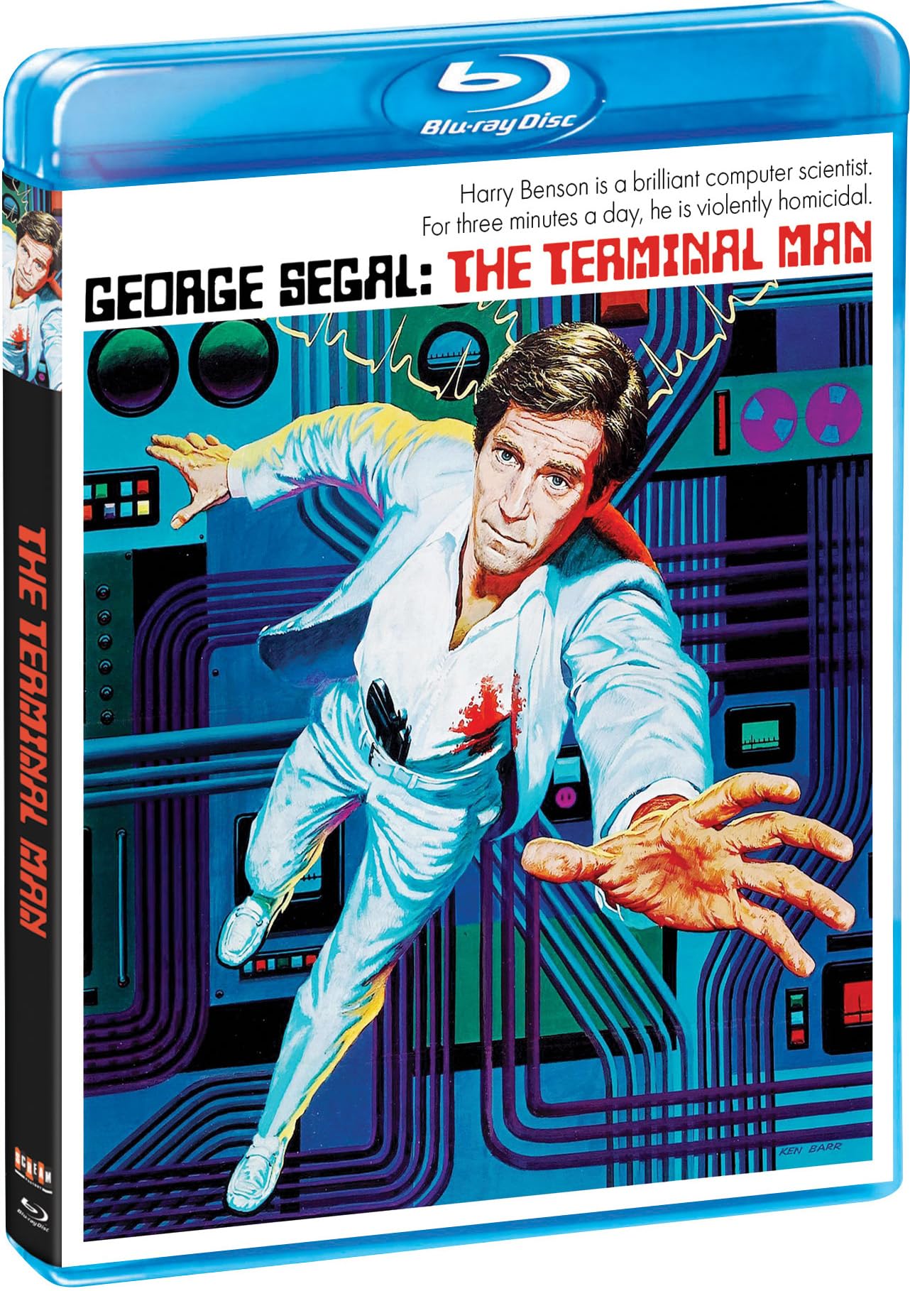 Amazon.com: The Terminal Man [Blu-ray] : Various: Movies & TV