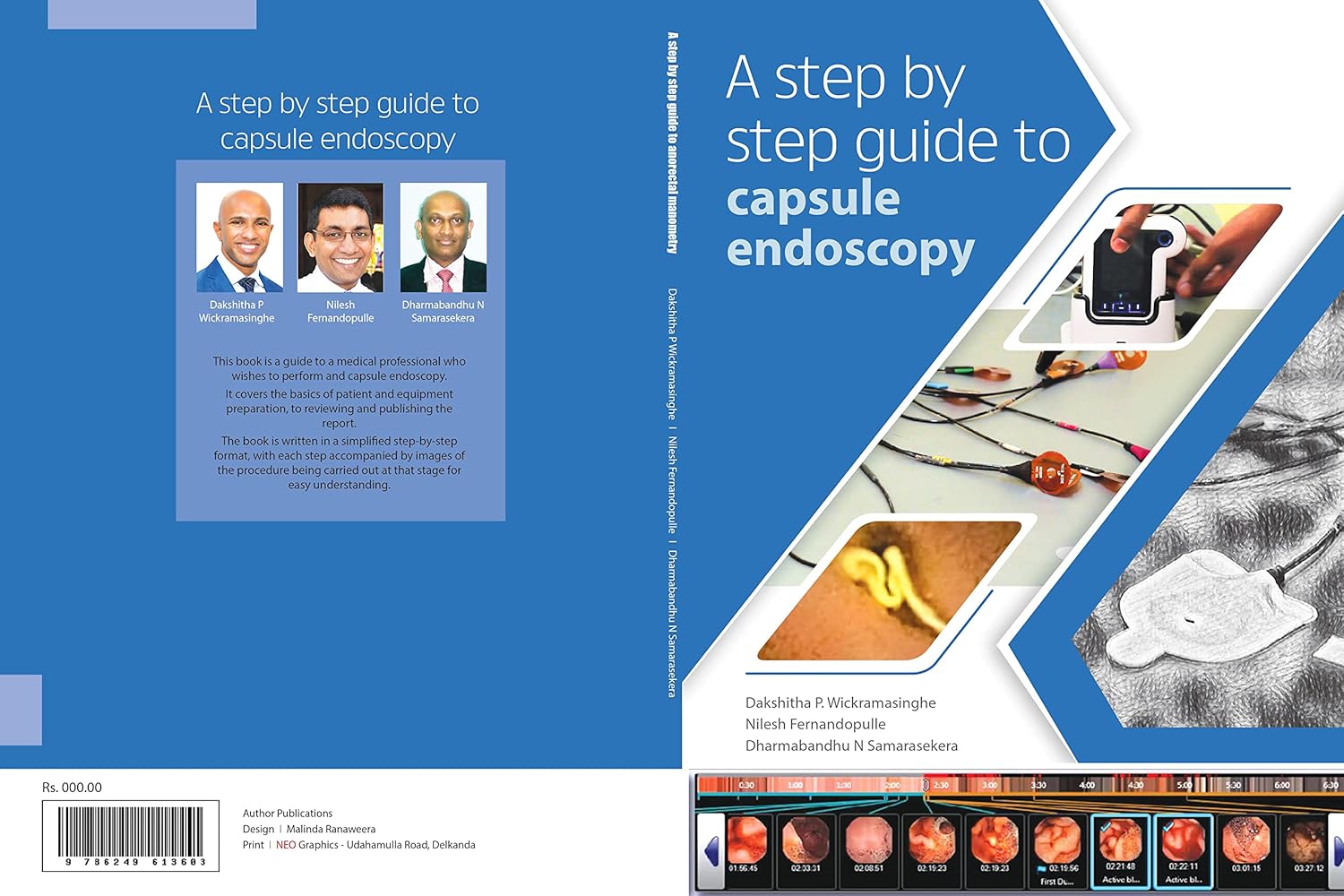 A step by step guide to capsule endoscopy eBook : Wickramasinghe ...