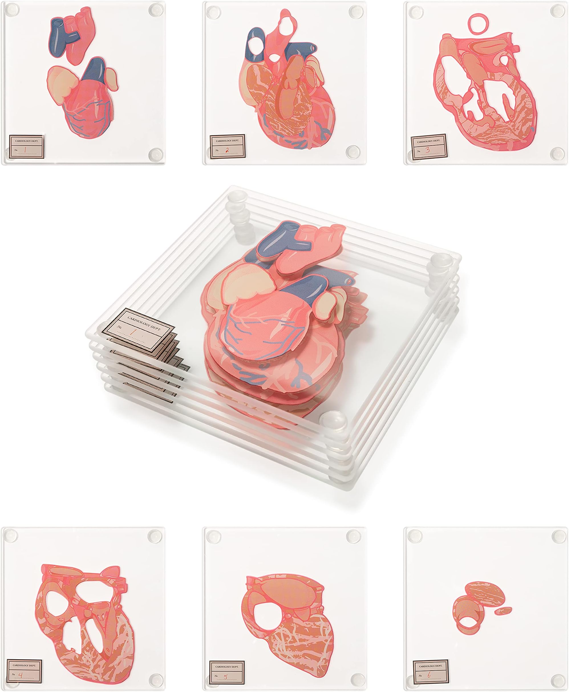 Amazon.com: Anatomic Heart Specimen Coasters (Set of 6) - 3D Brain ...
