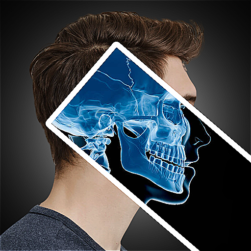 X-Ray Body Scanner - App on Amazon Appstore