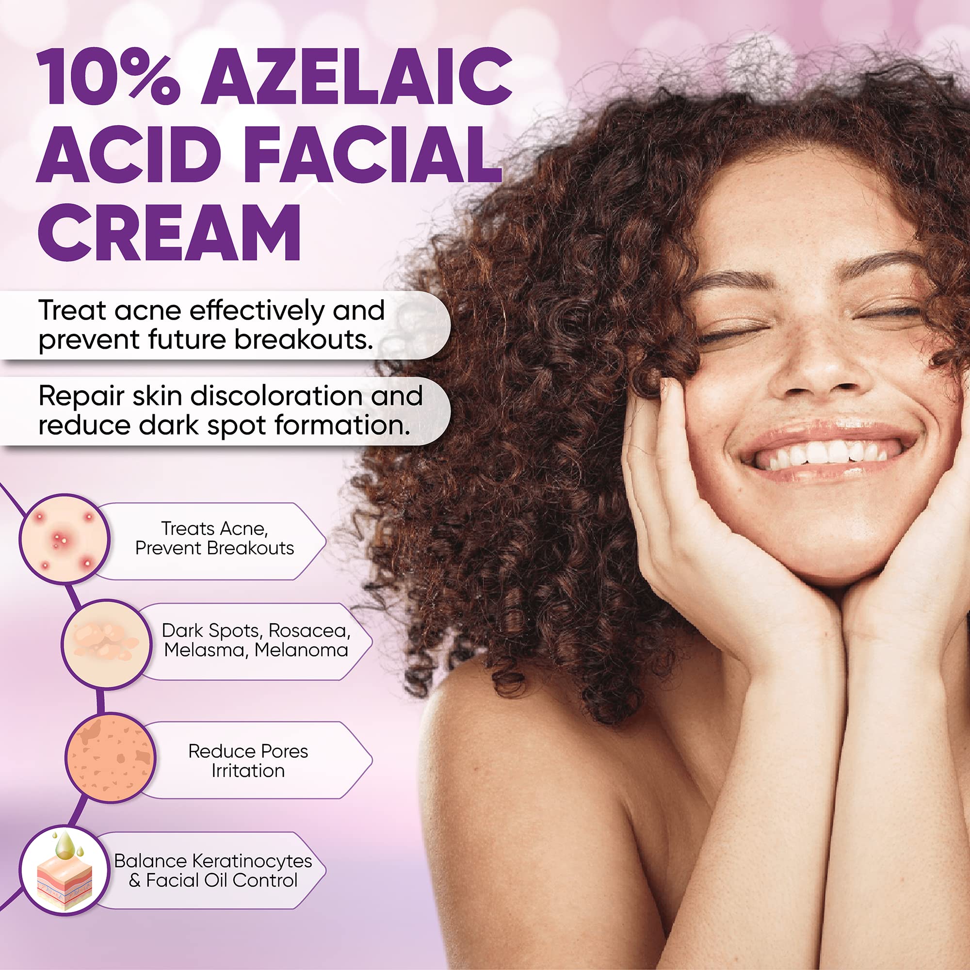 Snapklik.com : AOBBIY 10% Azelaic Acid Cream: Acne Treatment - Acne ...