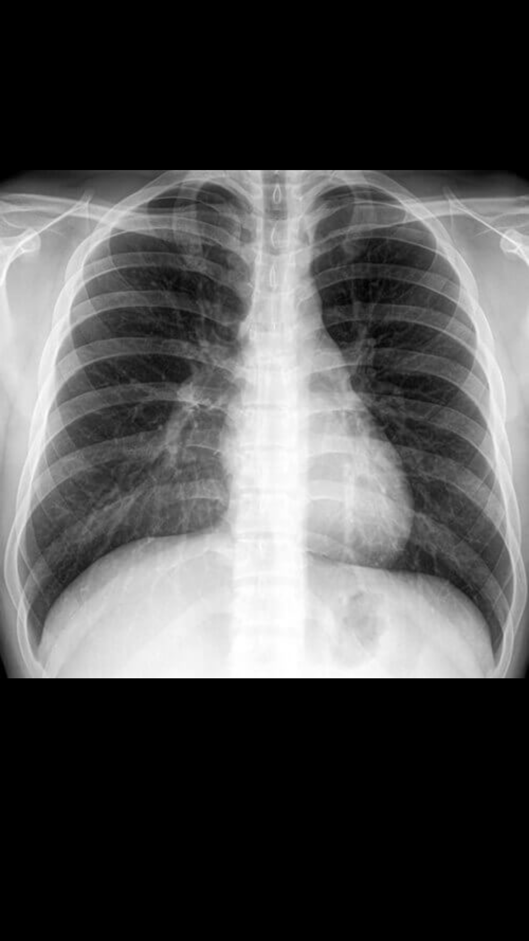 X-ray Scanner Prank - App on Amazon Appstore