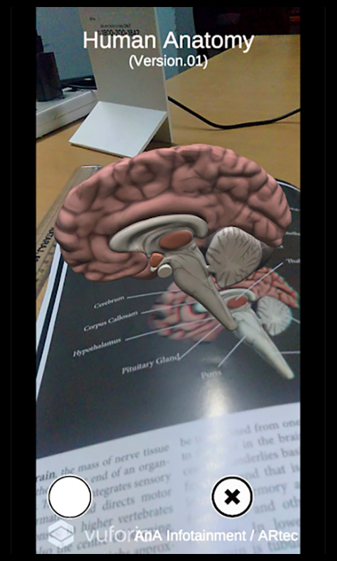 AR Anatomy - App on Amazon Appstore