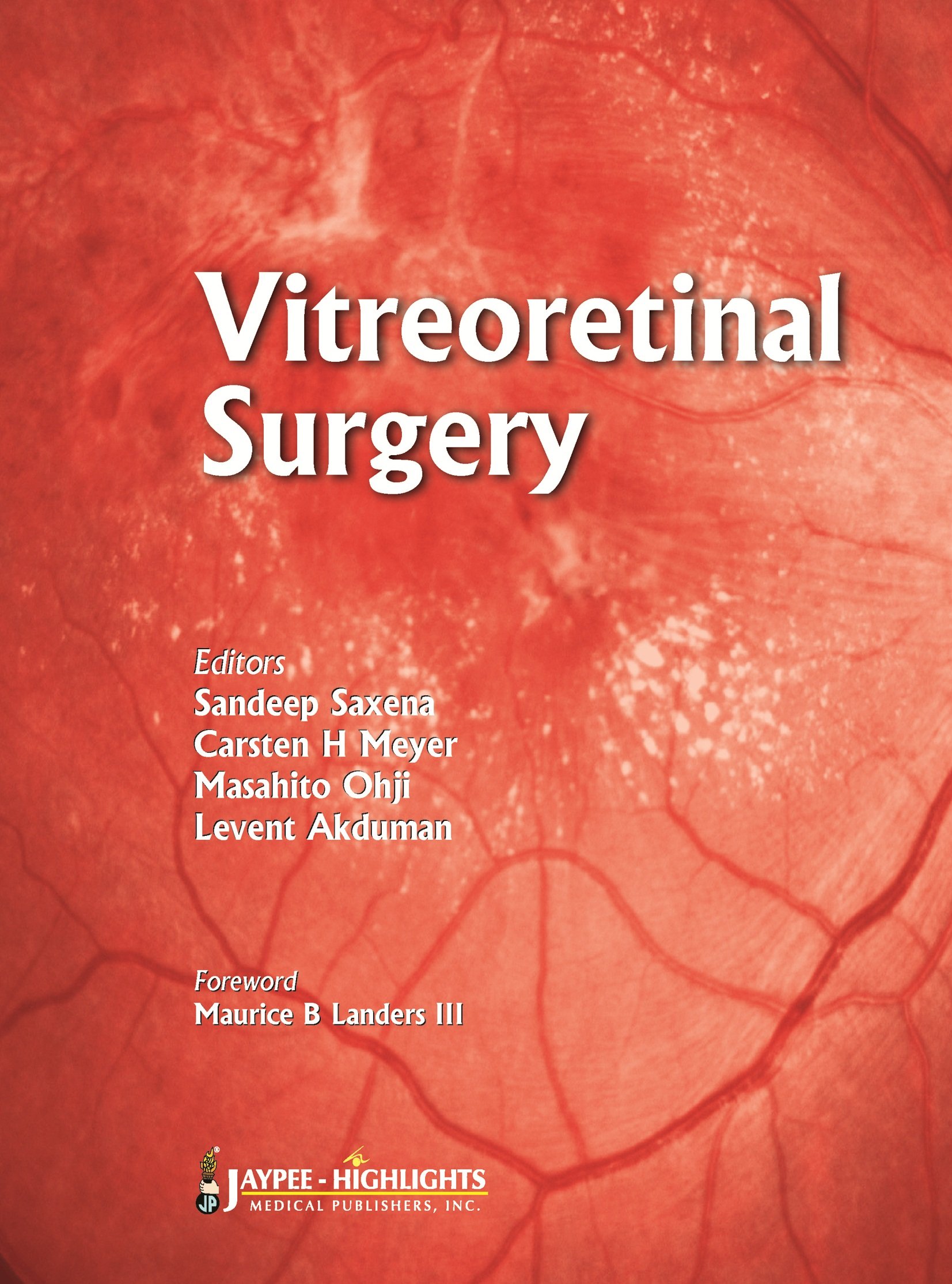 Vitreoretinal Surgery: 9789350906194: Medicine & Health Science Books ...