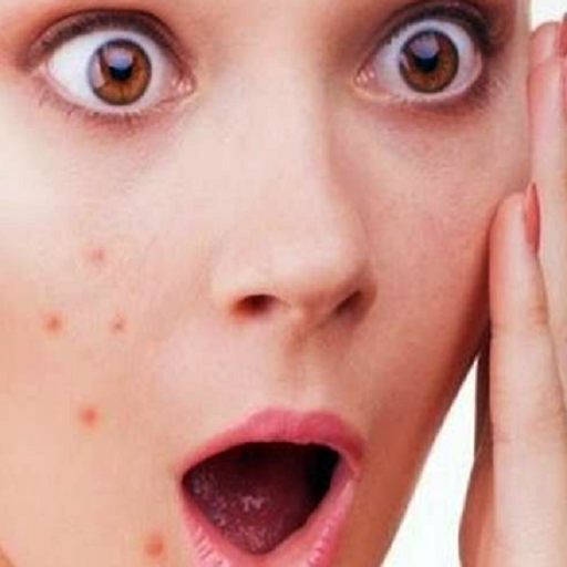 Get Rid of Acne Overnight Fast - App on Amazon Appstore