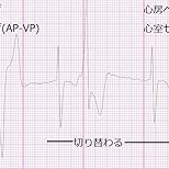 Amazon.co.jp: オムロンHCG-801用 心電図印刷ソフト HCG-SOFT-2 : 産業・研究開発用品