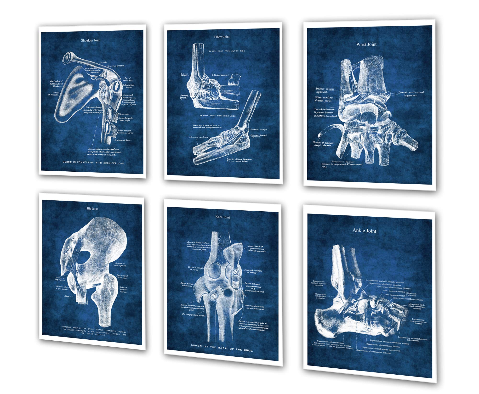 Amazon.com: Orthopedic Decor Posters set of 6 unframed Art Human ...