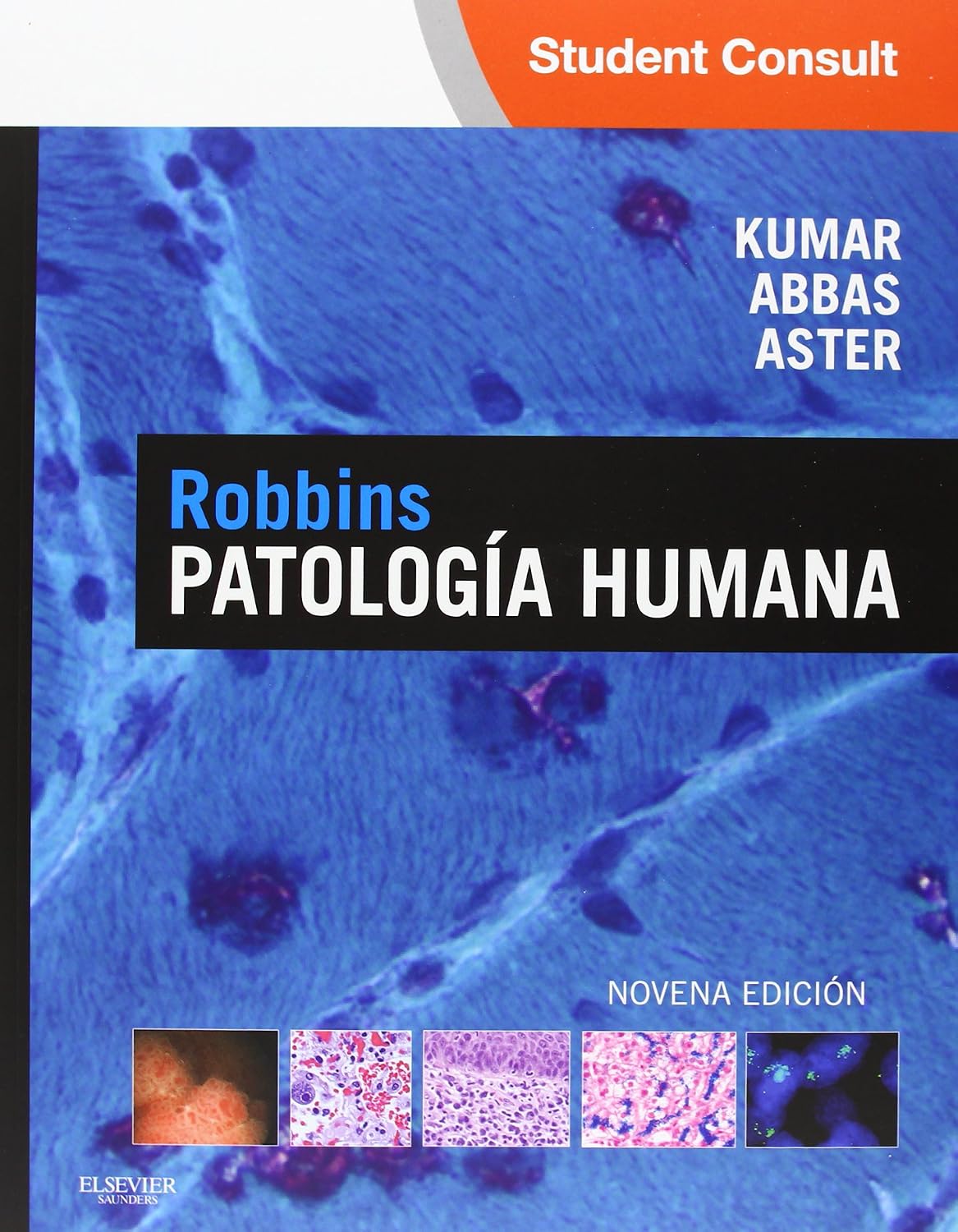 Amazon.com: Robbins. Patología humana + StudentConsult (Spanish Edition ...