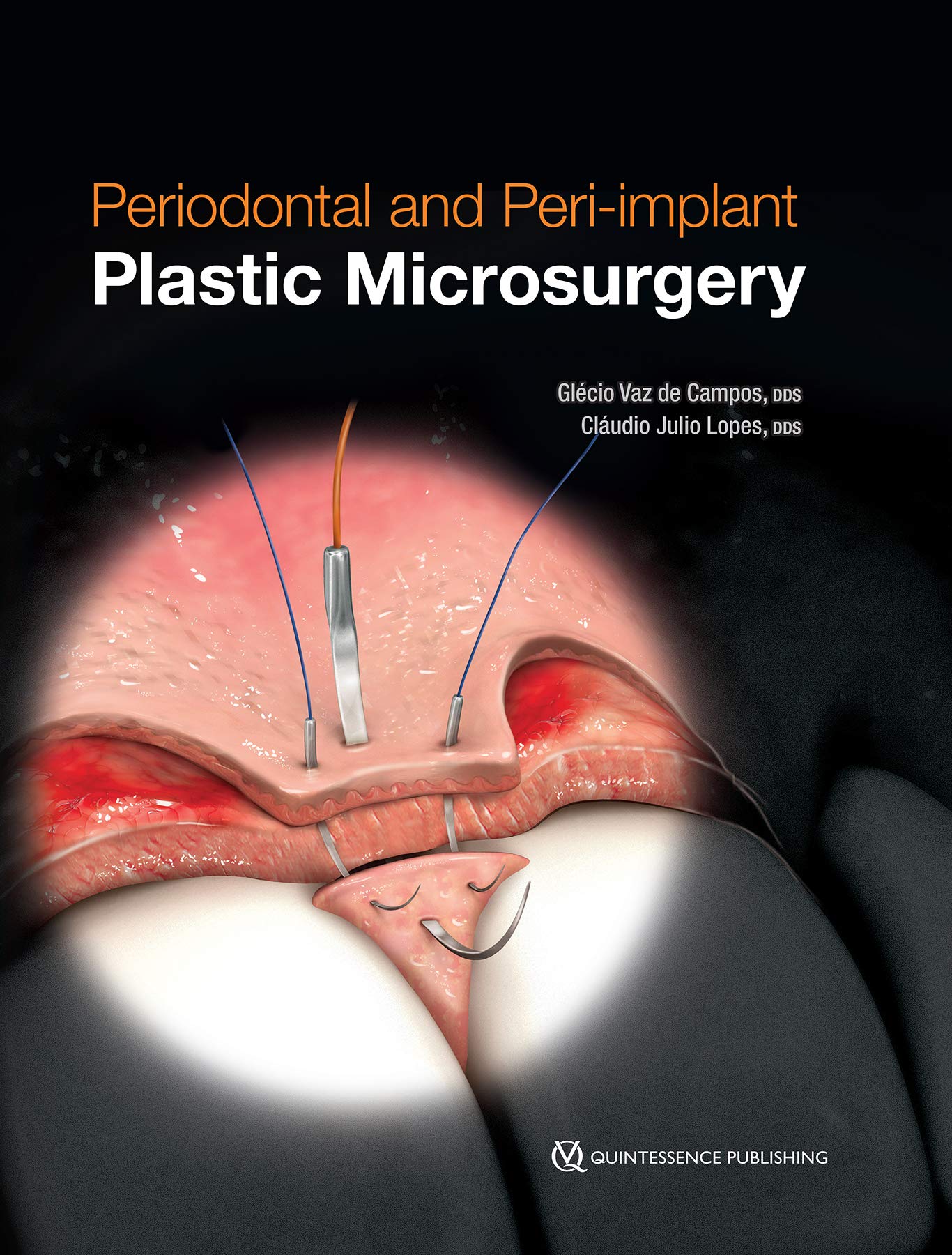 Periodontal and Peri-Implant Microsurgery (Minimally Invasive ...
