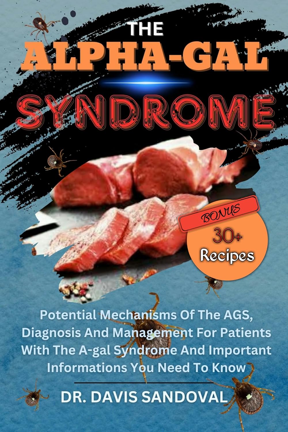 The Alpha-Gal Syndrome: Potential Mechanisms Of The AGS, Diagnosis And ...