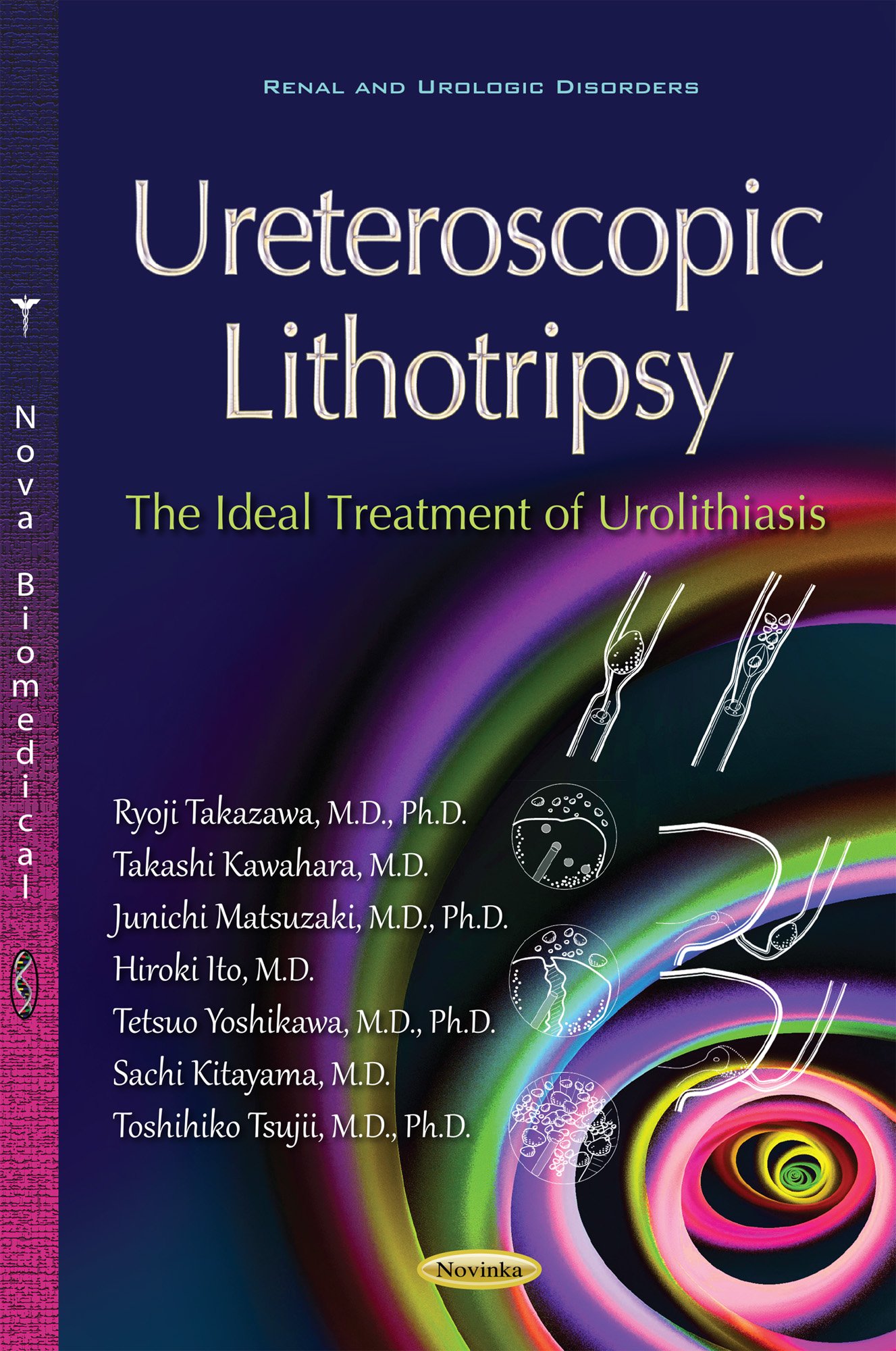 Ureteroscopic Lithotripsy The Ideal Treatment Of Urolithiasis Renal And ...