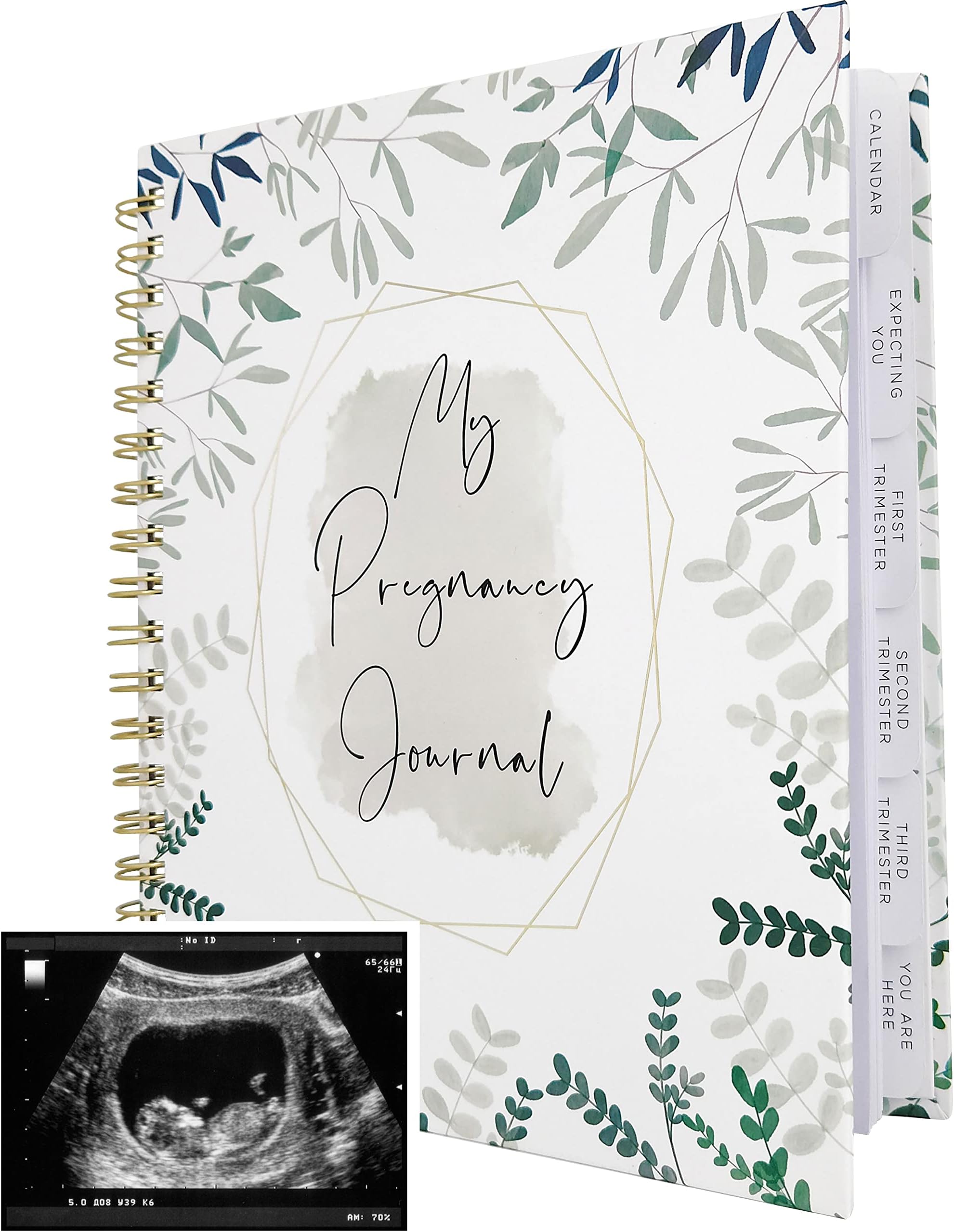 Amazon.com: Pregnancy Journal, Pregnancy Books For First Time Mom, With ...