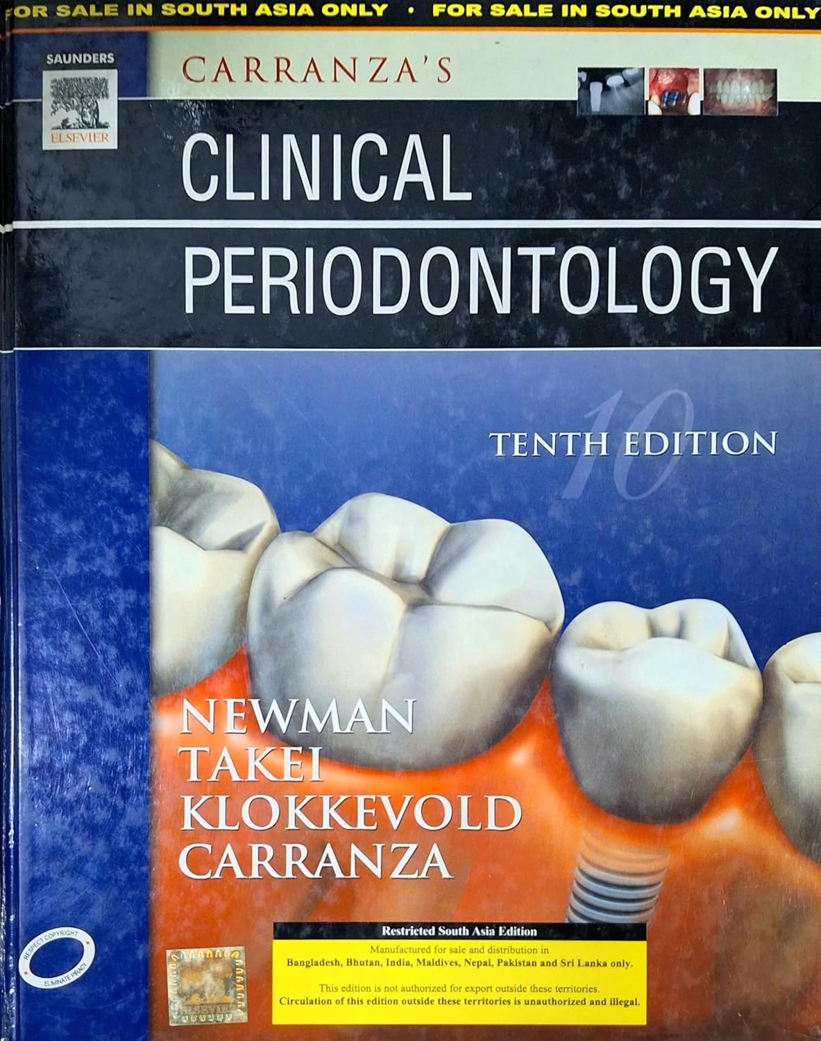 Buy Carranza's Clinical Periodontology (10th Edition) Book Online at ...
