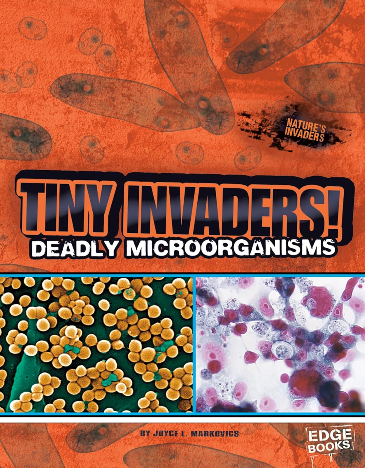 Tiny Invaders!: Deadly Microorganisms (Nature's Invaders): Markovics ...