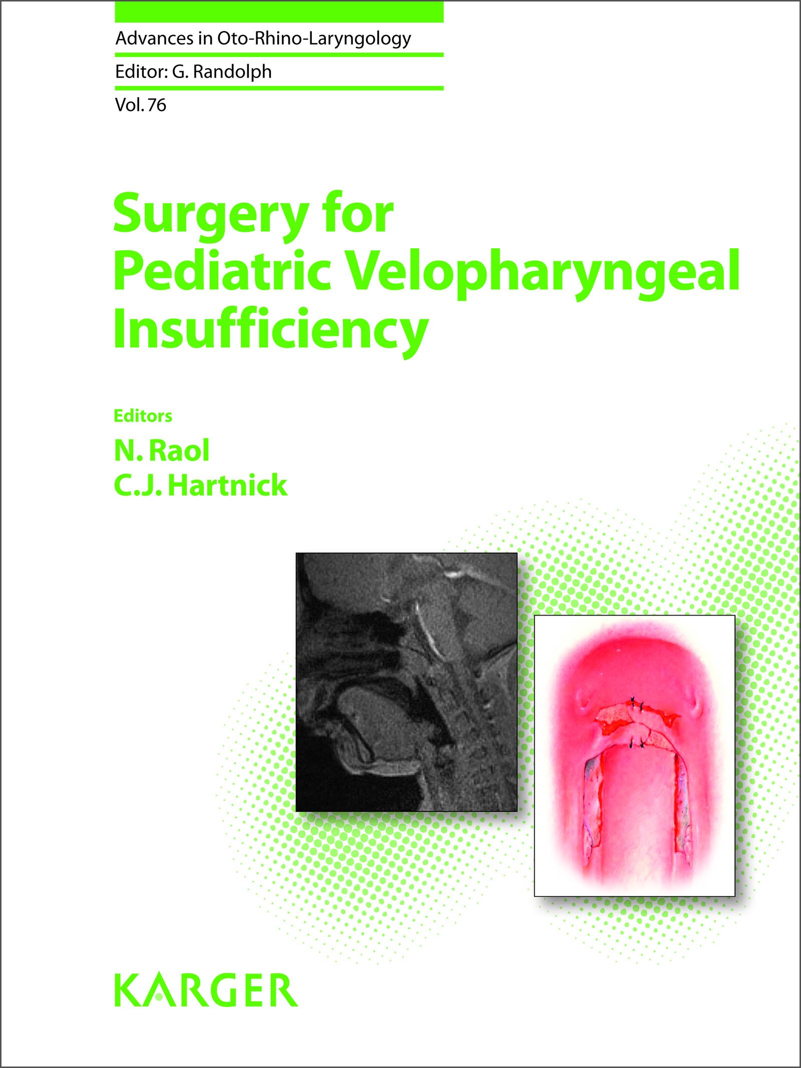 Surgery for Pediatric Velopharyngeal Insufficiency (Advances in Oto ...