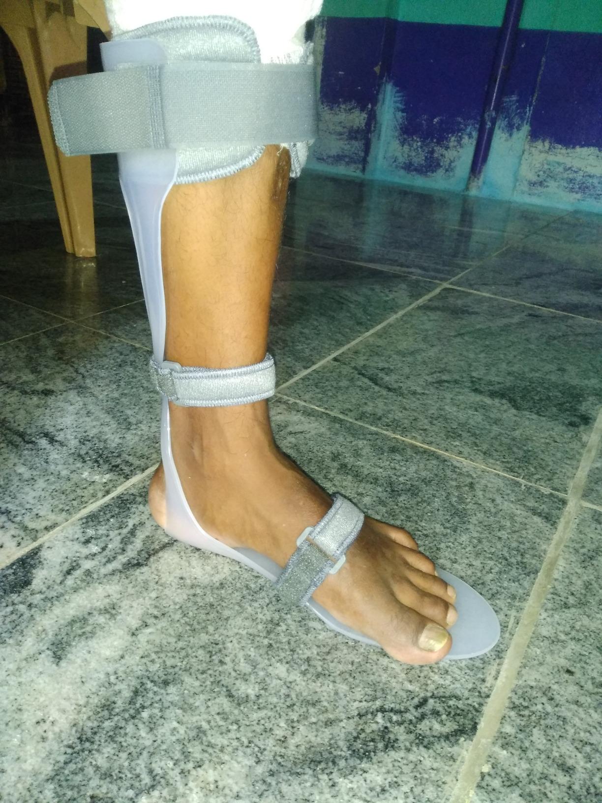 Buy Pedisdrop Dyna Ankle Foot Orthosis Foot Drop Splint (L-Left) Online ...