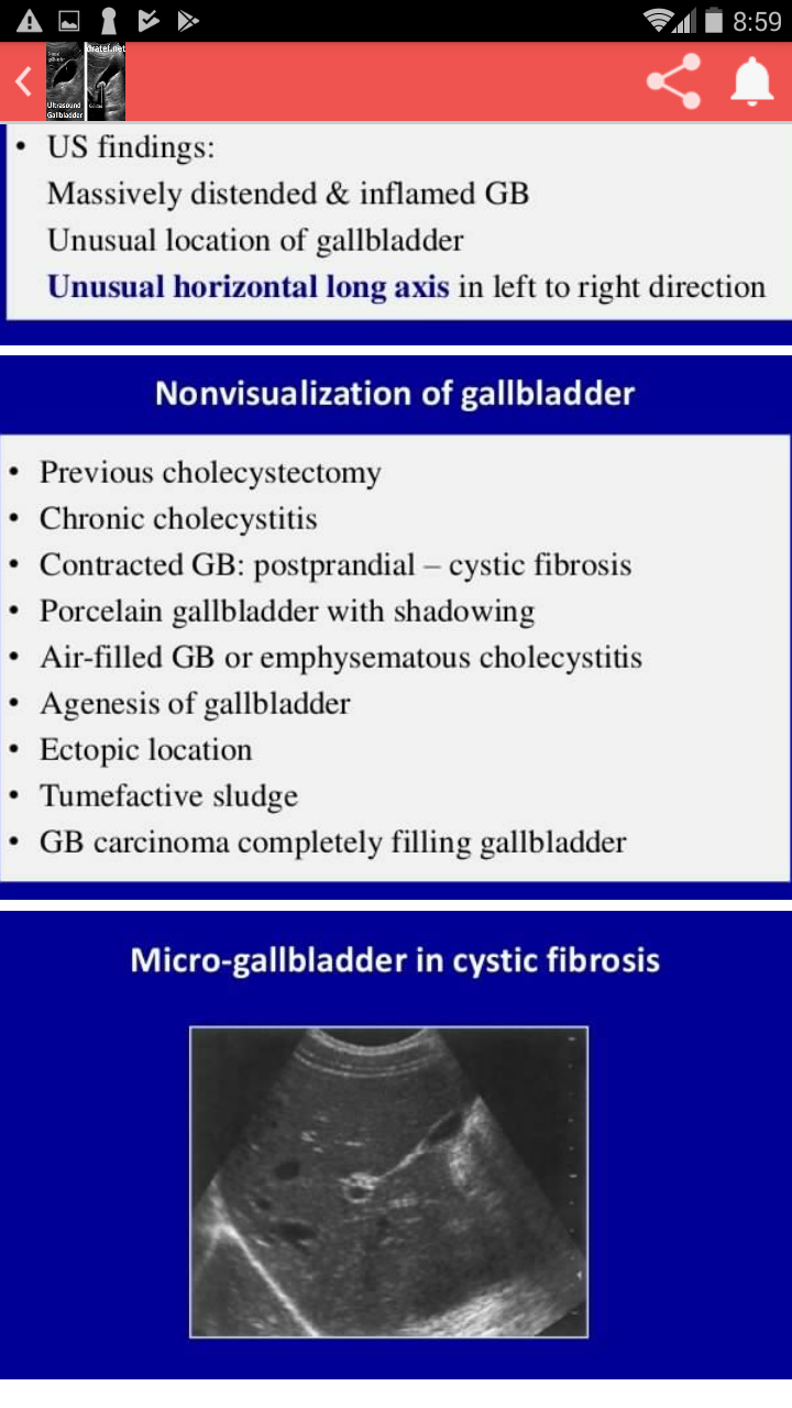 UltraSound Gallbladder - App on Amazon Appstore