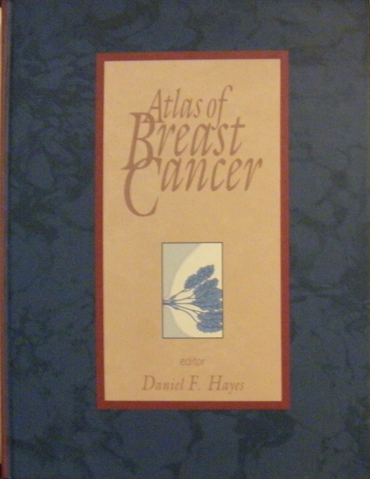 Atlas of Breast Cancer: Eberlein, Timothy J., M.D., Recht, Abram ...
