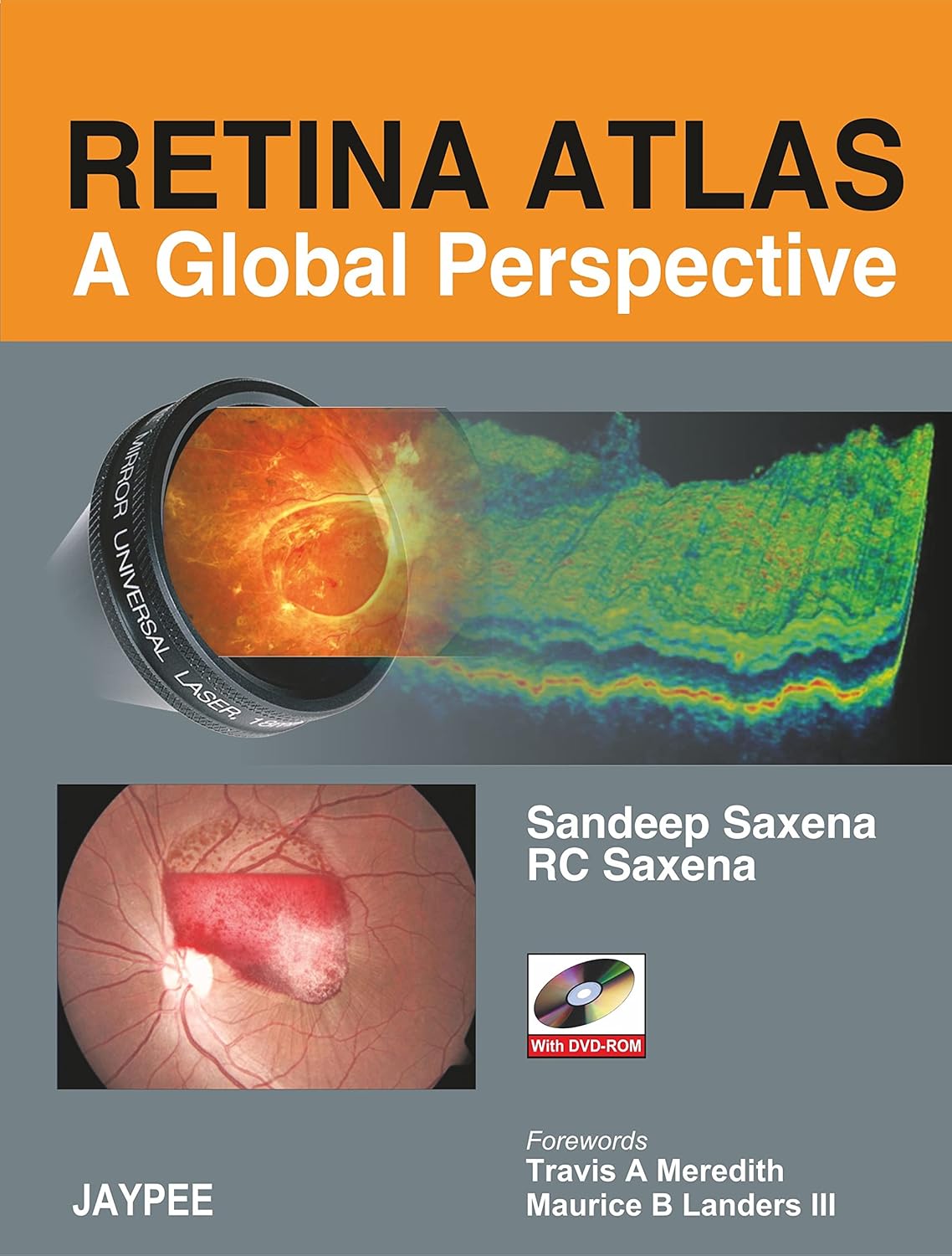Retina Atlas - A Global Perspective: 9788184482195: Medicine & Health ...