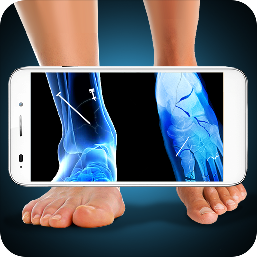X Ray Fracture Foot Prank - App on Amazon Appstore