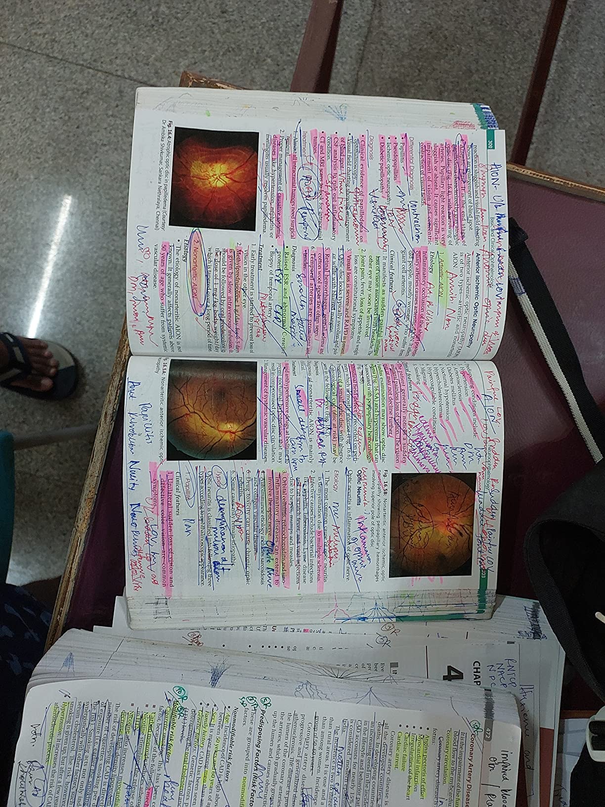 Buy BASIC AND CLINICAL OPHTHALMOLOGY AS PER CMBE CURRICULUM COMPETENCY ...