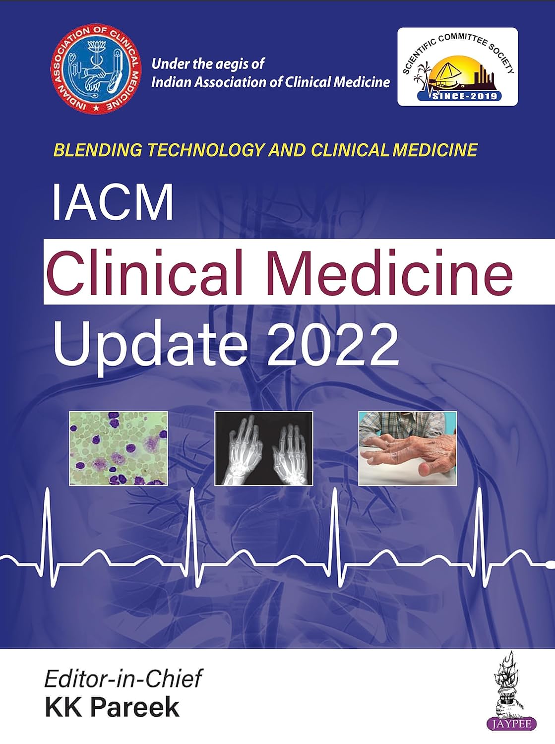 IACM Clinical Medicine Update 2022 eBook : Pareek, KK: Amazon.in ...