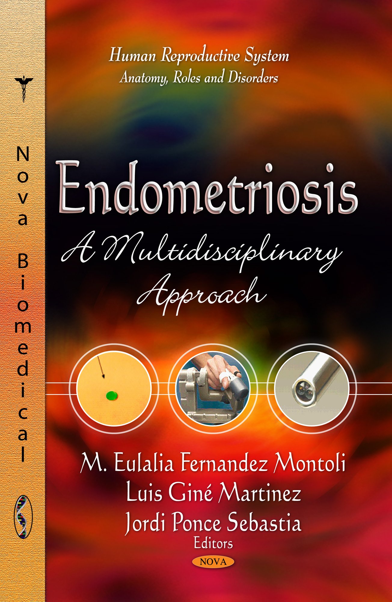 Endometriosis: A Multidisciplinary Approach (Human Reproductive System ...