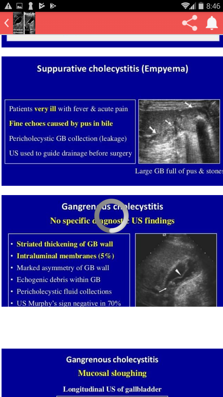 UltraSound Gallbladder - App on Amazon Appstore