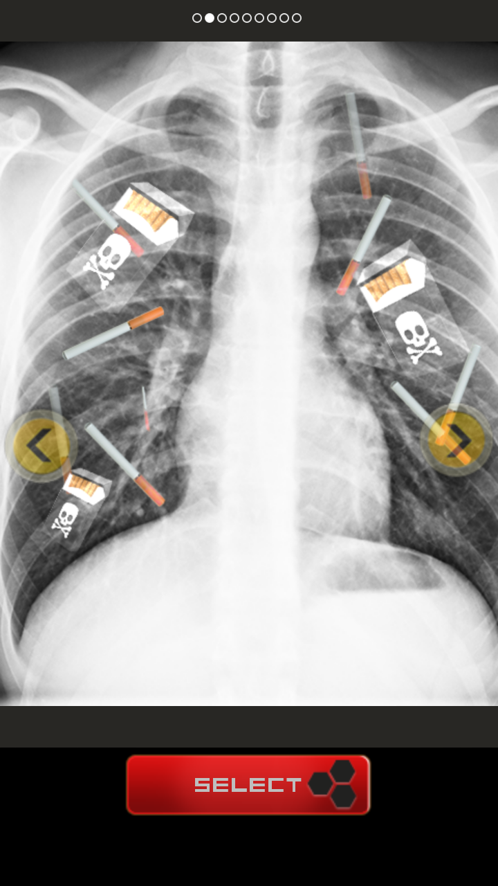 X-Ray scanner - App on Amazon Appstore