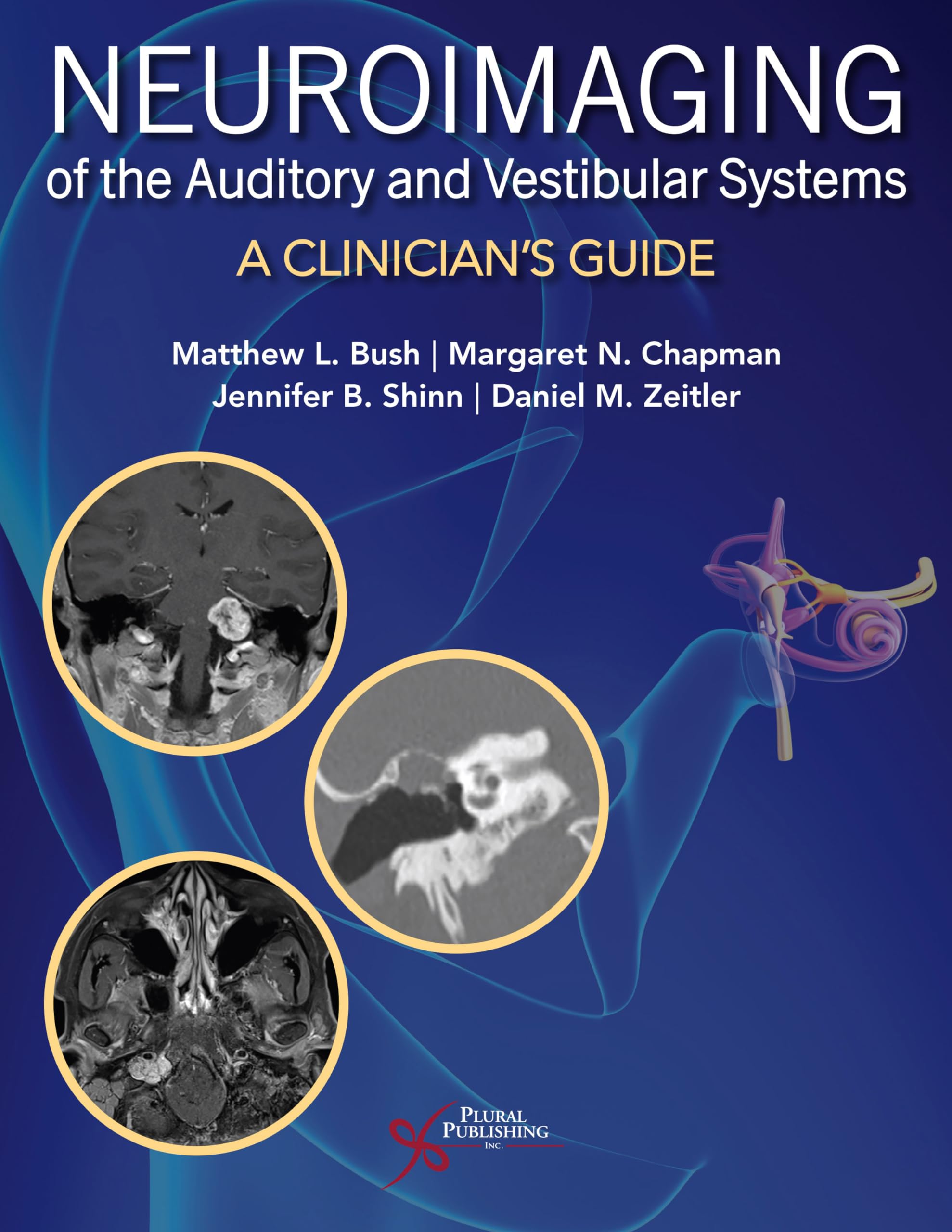 Neuroimaging of the Auditory and Vestibular Systems: A Clinician’s ...