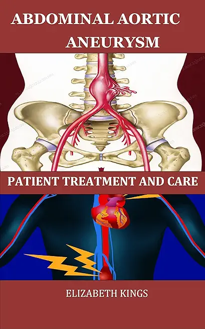 Understanding The Link Between Abdominal Aortic Aneurysm And Lower Back ...