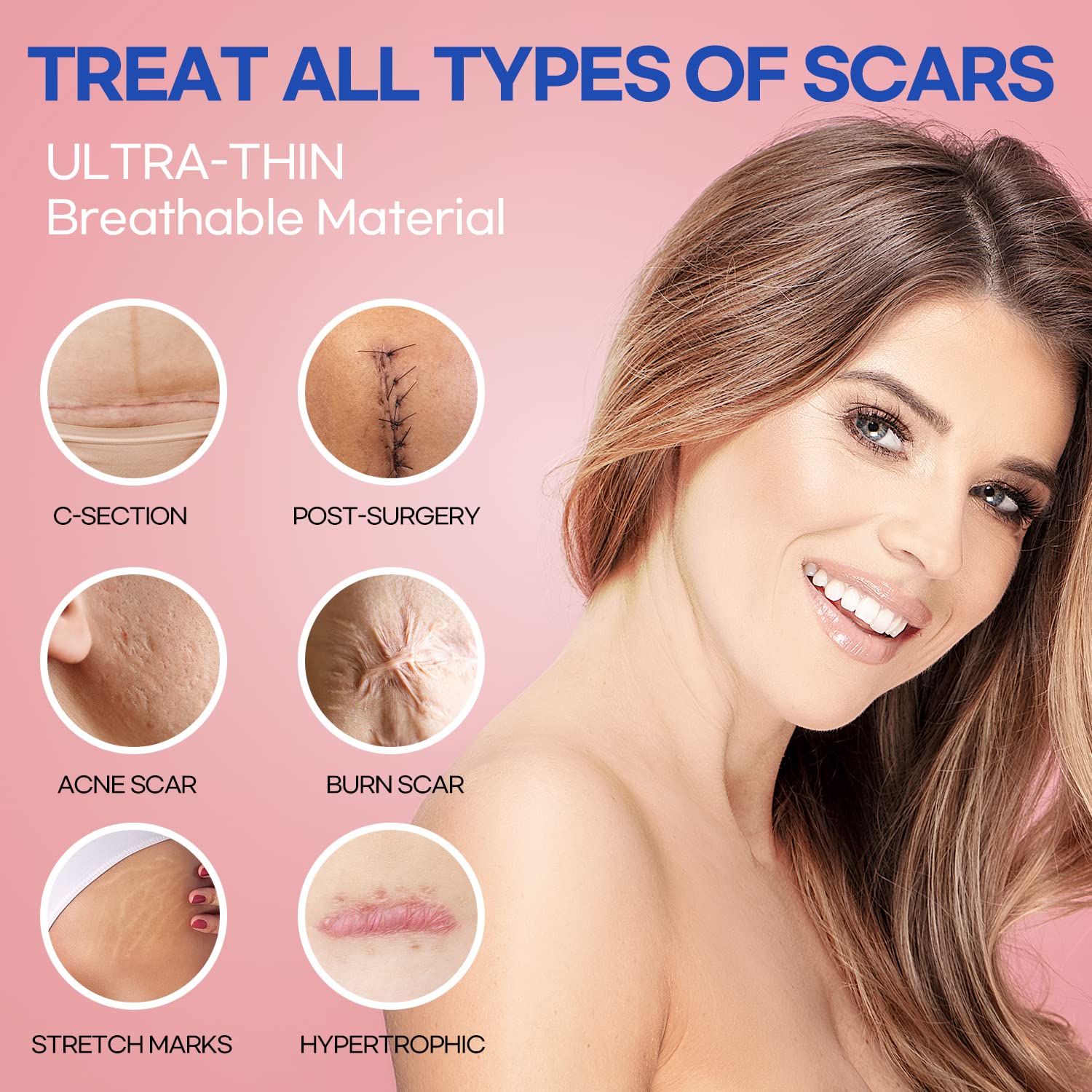 Snapklik.com : 2 Sizes Sheet Silicone Scar Removal Sheets For Diverse ...