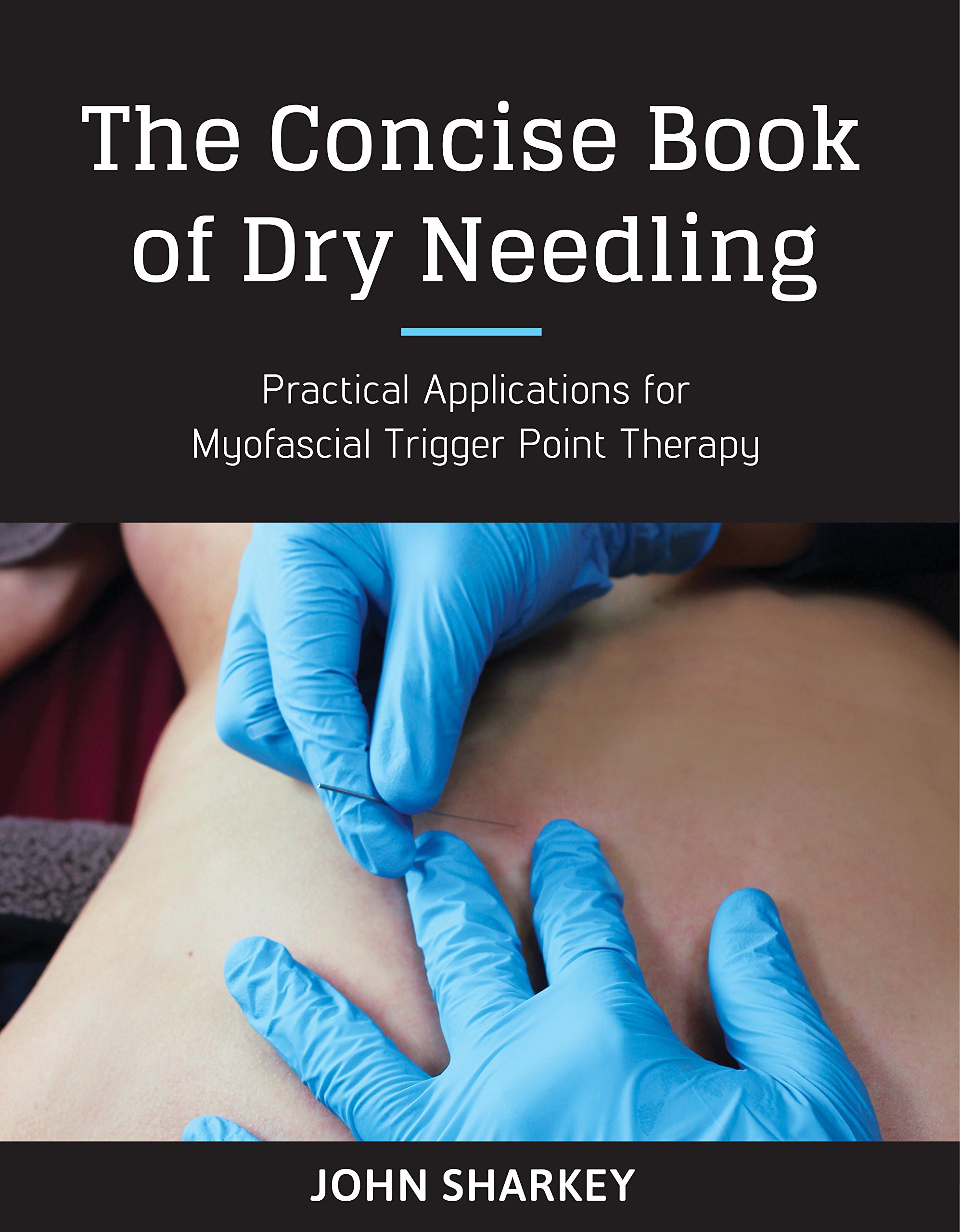 Buy The Concise Book of Dry Needling: A Practitioner's Guide to ...