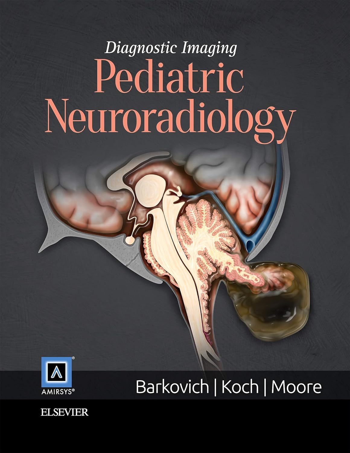Diagnostic Imaging: Pediatric Neuroradiology: 9781931884853: Medicine ...