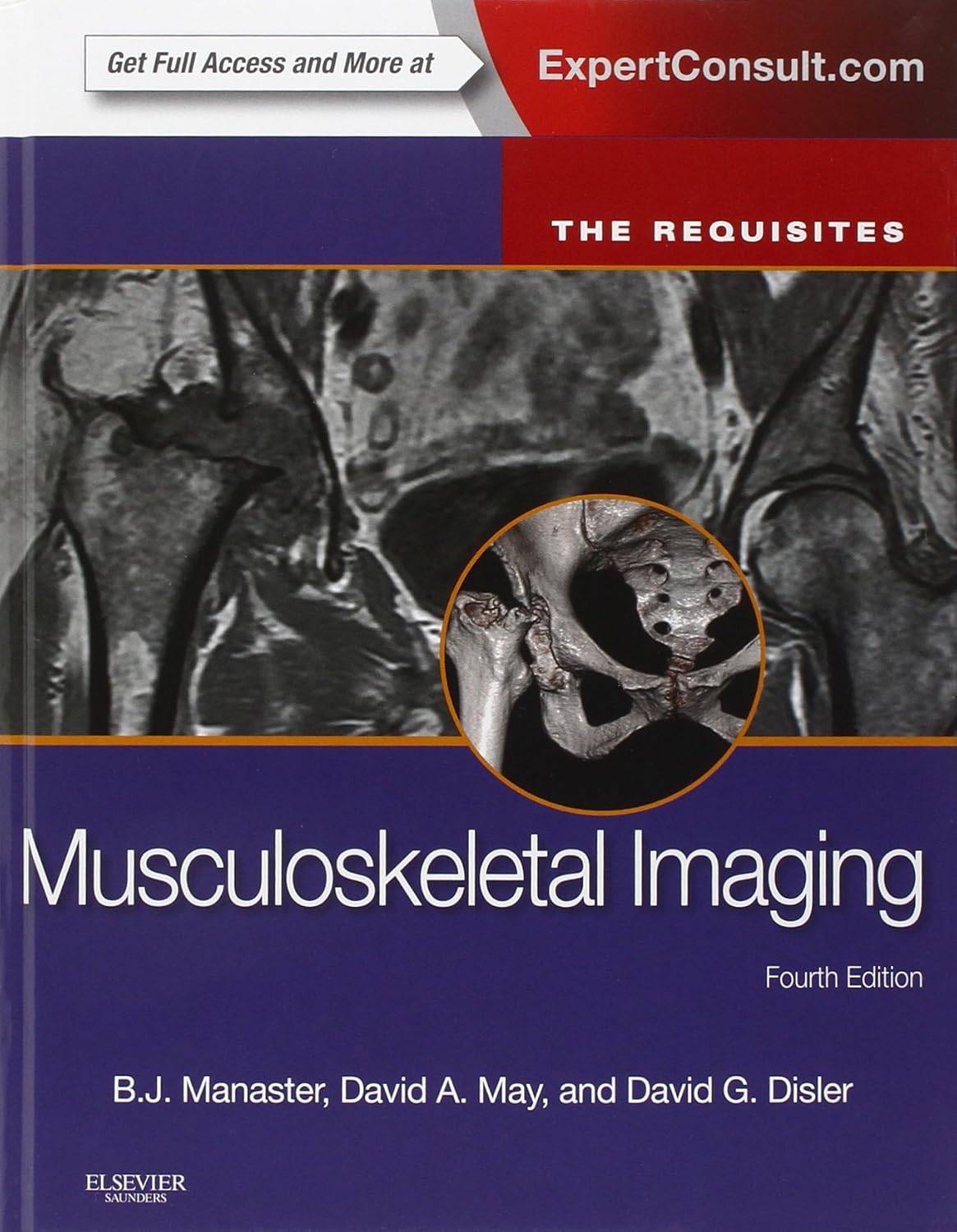 Buy Musculoskeletal Imaging: The Requisites (Expert Consult- Online and ...