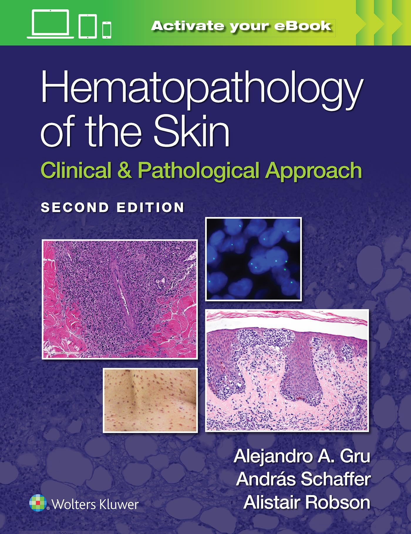 Hematopathology of the Skin: Clinical & Pathological Approach ...