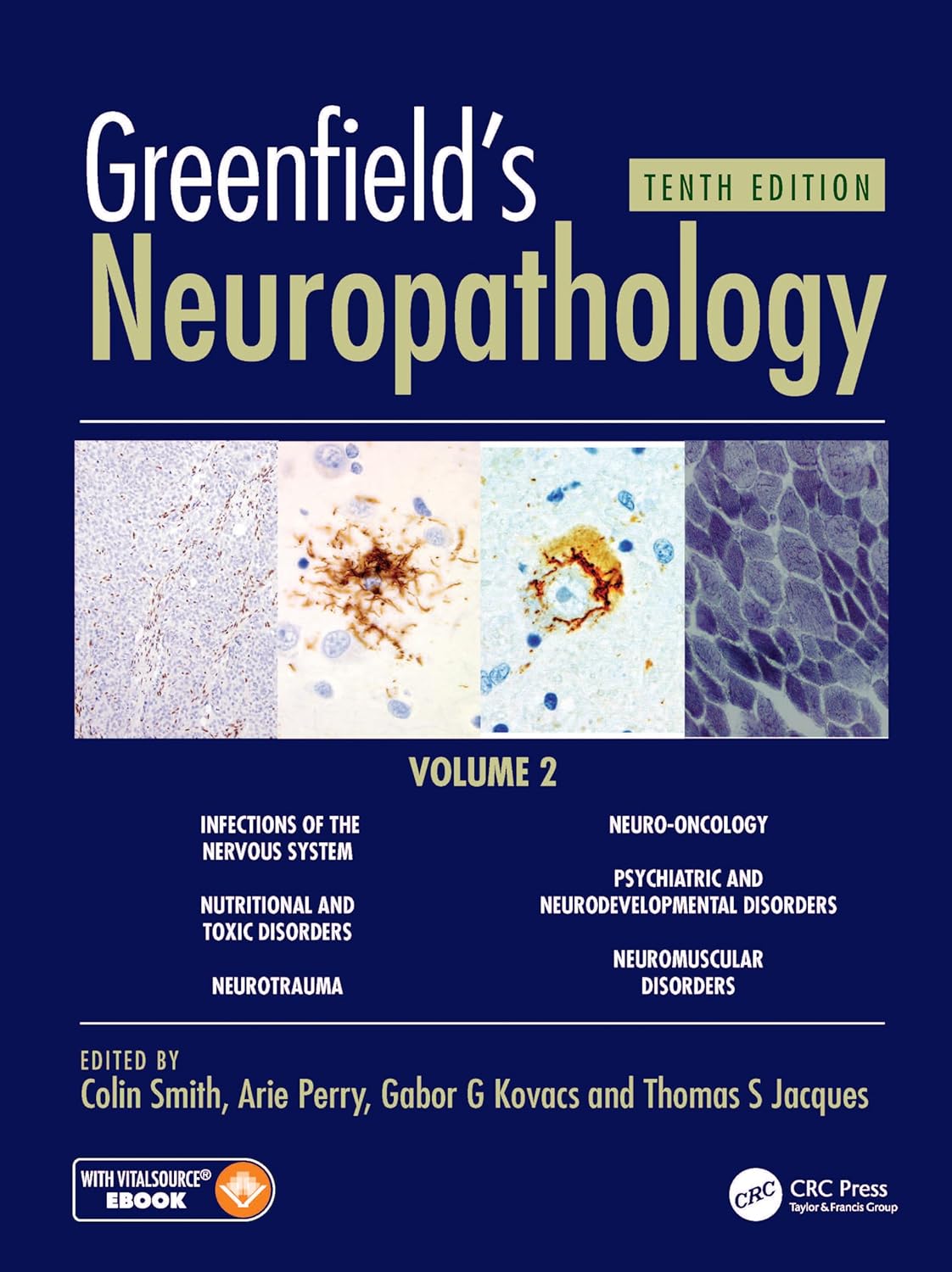 Greenfield's Neuropathology 10e Vol 2: 9781032481395: Medicine & Health ...