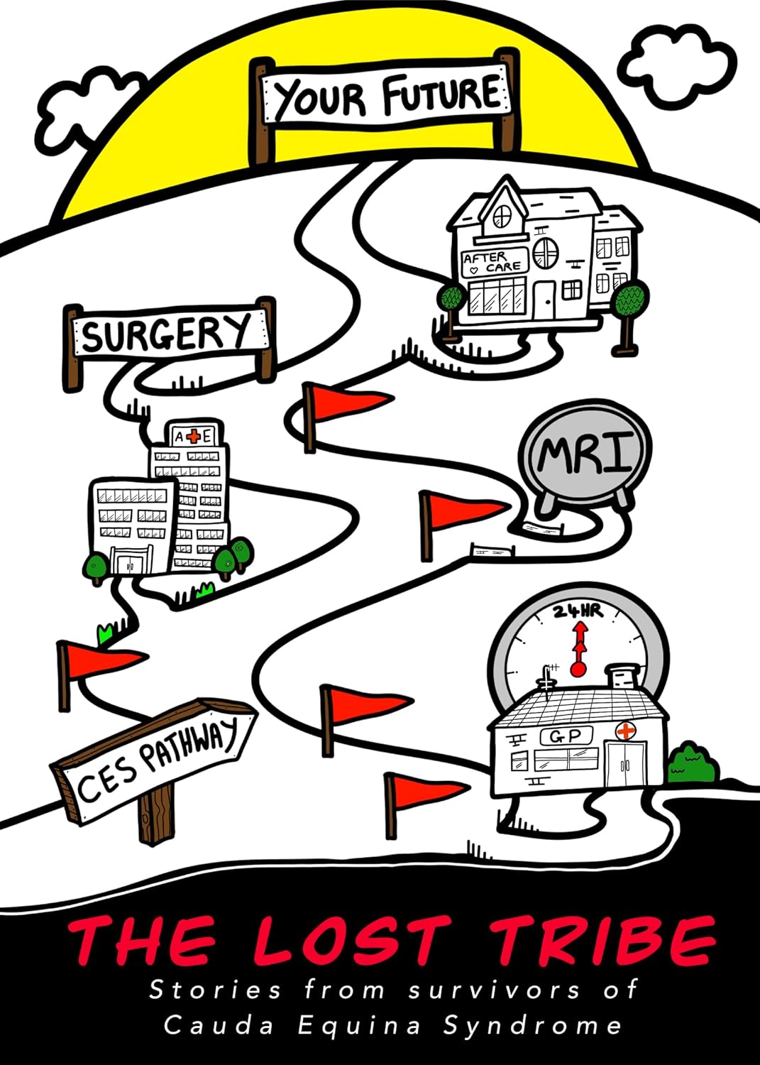 The Lost Tribe: Stories from Survivors of Cauda Equina Syndrome eBook : Champions Charity, Cauda ...