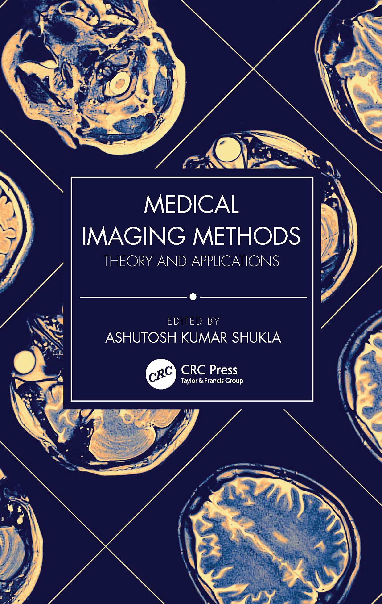 Medical Imaging Methods: Theory and Applications: 9780367630812 ...