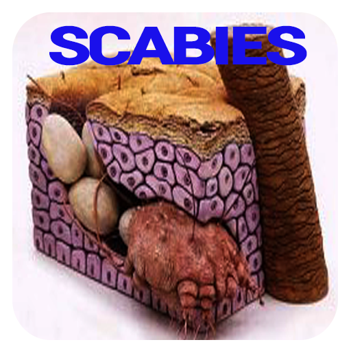 Scabies Disease - App on Amazon Appstore