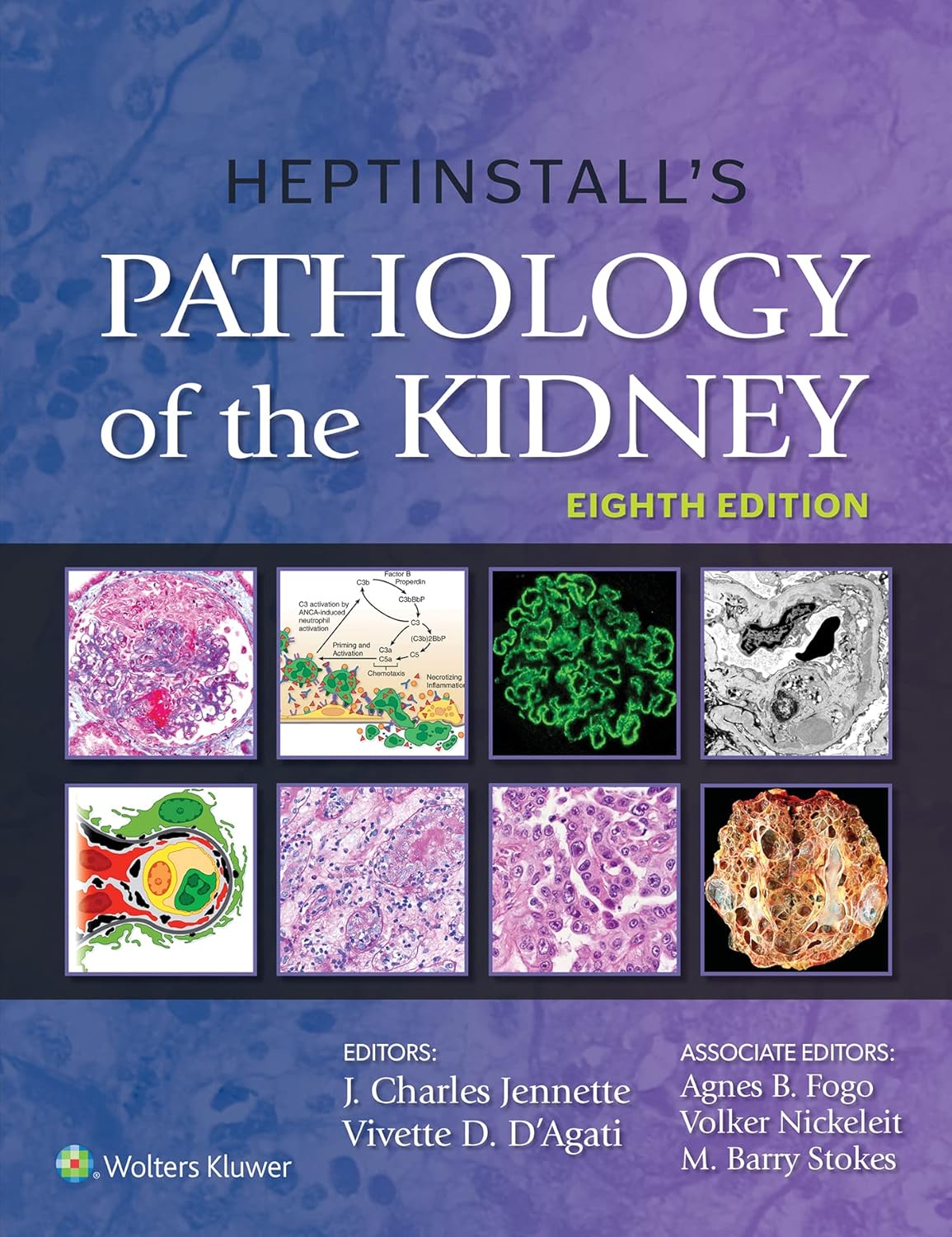 Heptinstall's Pathology of the Kidney eBook : Jennette, J. Charles, D ...