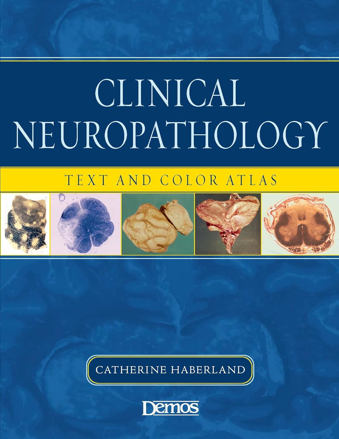 Clinical Neuropathology: Text and Color Atlas eBook : Haberland MD ...