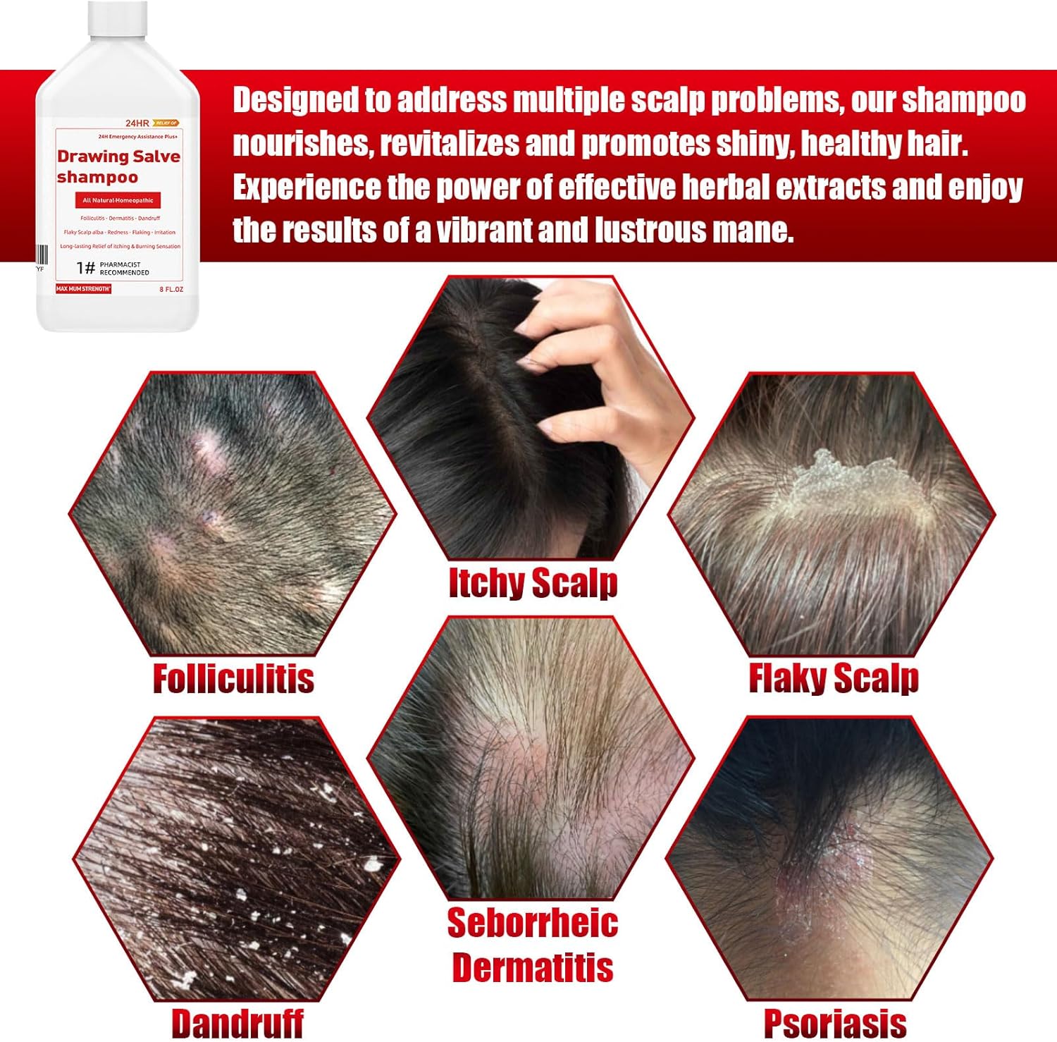 Folliculitis Shampoo, Seborrheic Dermatitis Shampoo, Australia | Ubuy