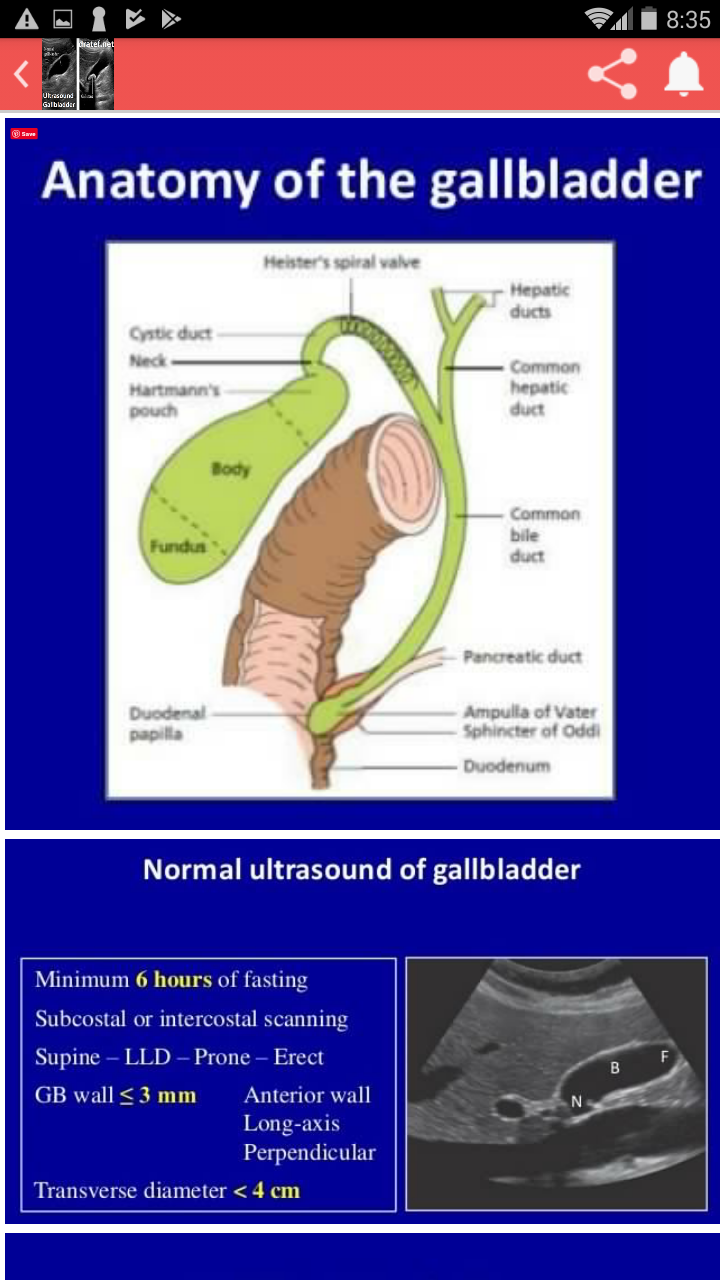 UltraSound Gallbladder - App on Amazon Appstore