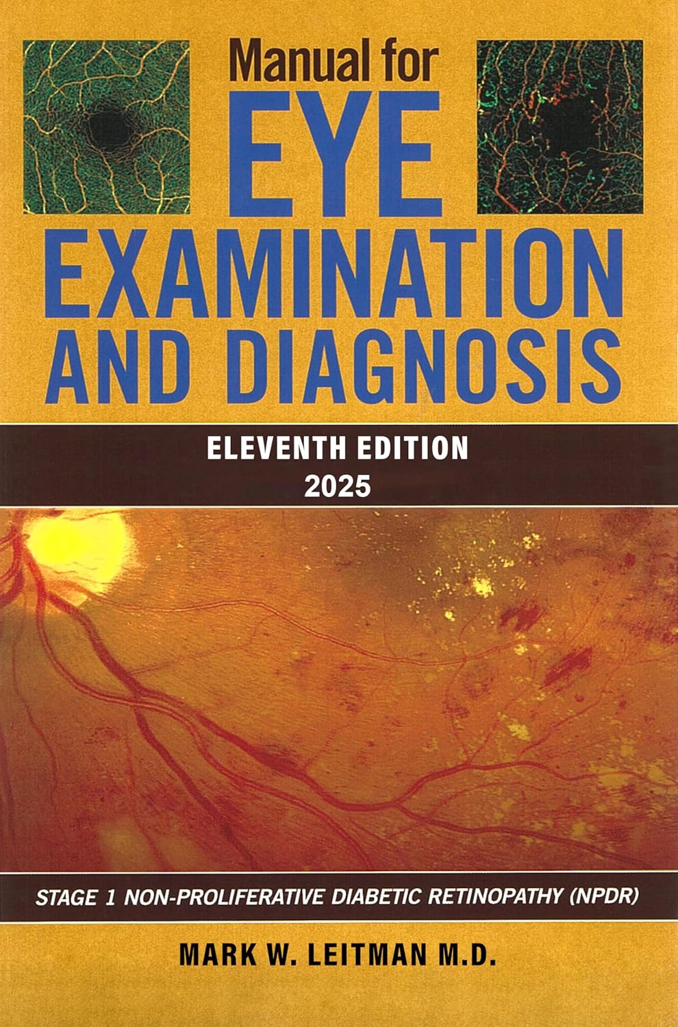 Manual for Eye Examination and Diagnosis (Eleventh Edition 2025): Stage ...