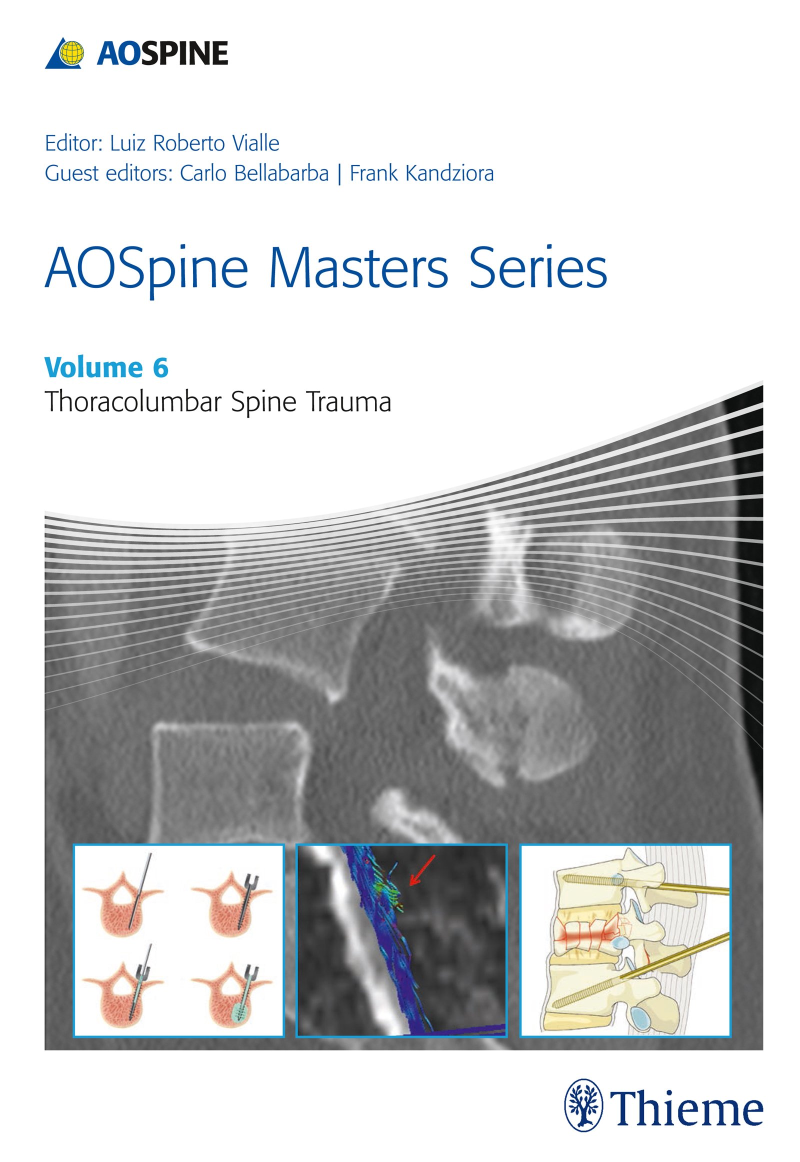 Buy AOSpine Masters Series, Volume 6: Thoracolumbar Spine Trauma Book ...