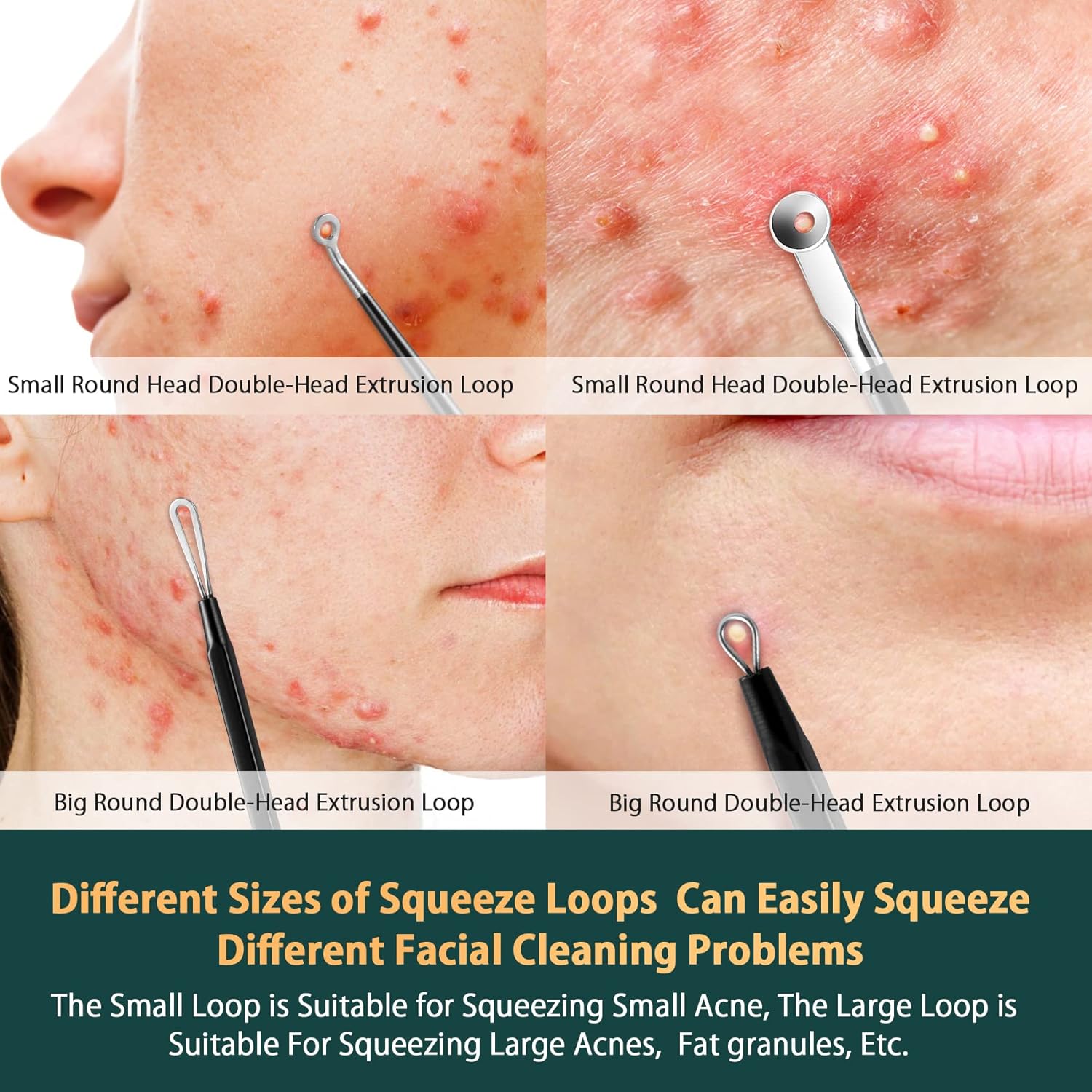 10 Pcs Blackhead Extraction Kit , Stainless Steel Acne Removal Kit for ...