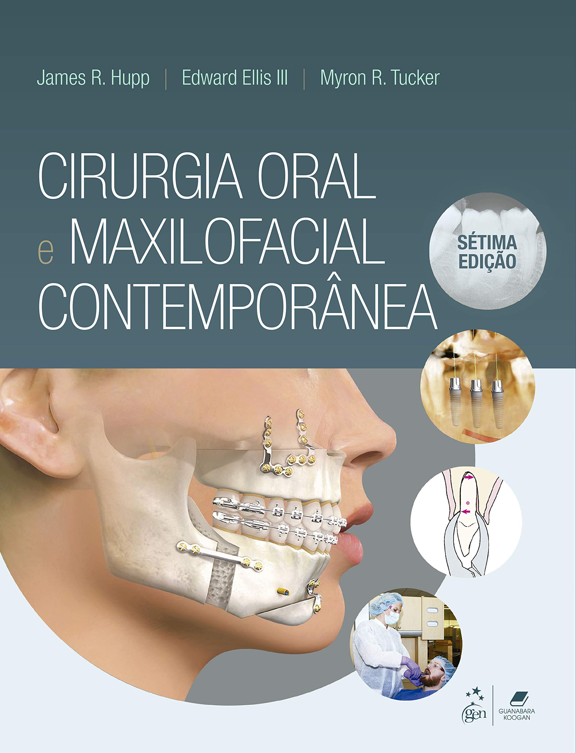 Cirurgia Oral e Maxilofacial Contemporânea : HUPP James R. ELLIS III ...